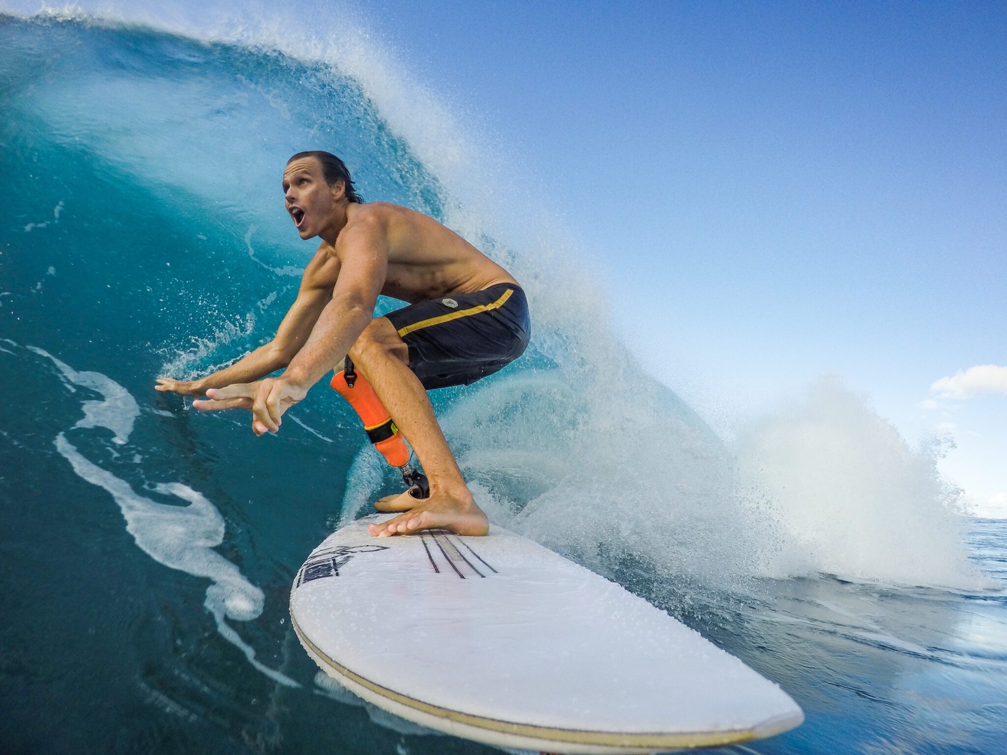 A life without limitations, engineered in Iceland - Nordic Investment Bank